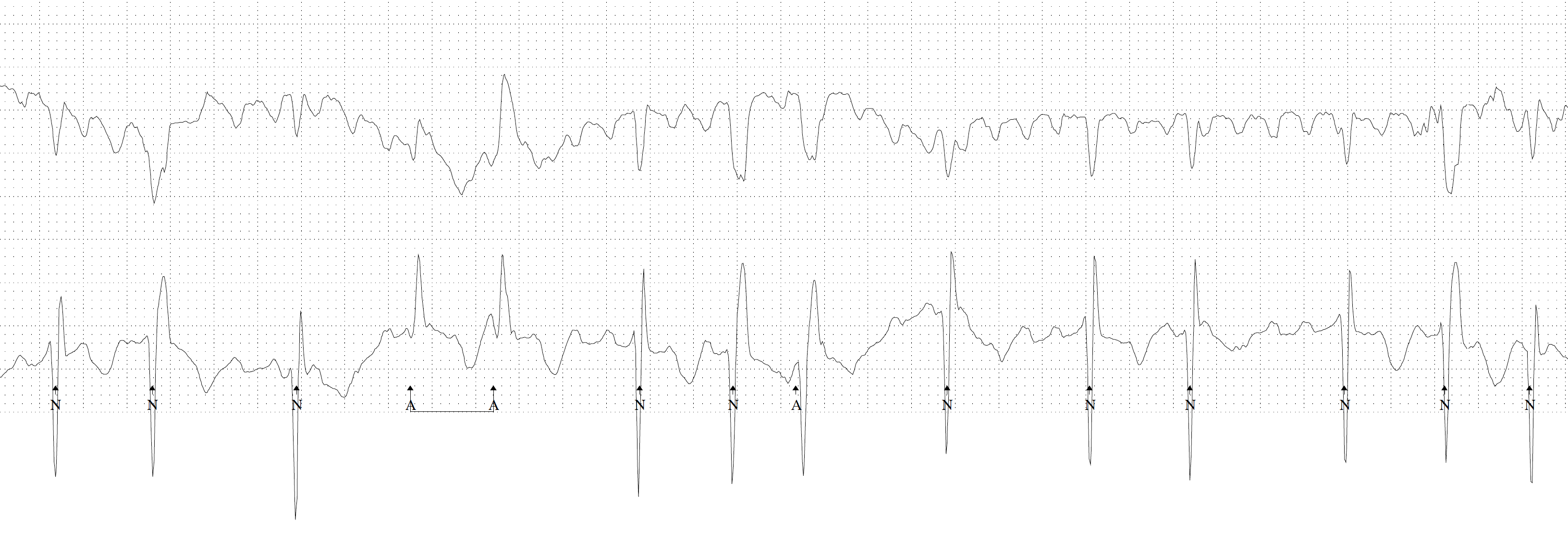 Dr Andrew Mitchell - Jersey Cardiologist