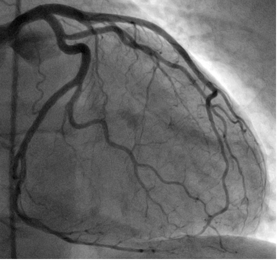 Dr Andrew Mitchell - Jersey Cardiologist